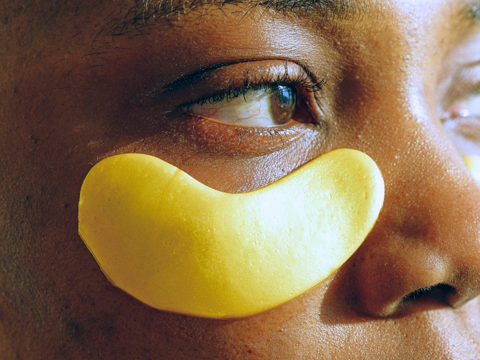 Vermindering van Collageen: hoe zit dat en wat kan Sculptra er tegen ...